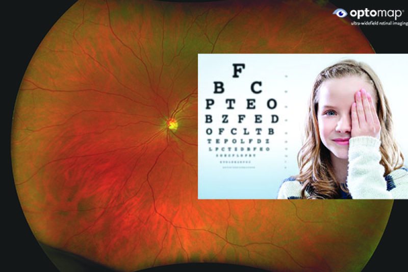 Services in Beaverton & Hillsboro, OR | Sunset Eye Clinic